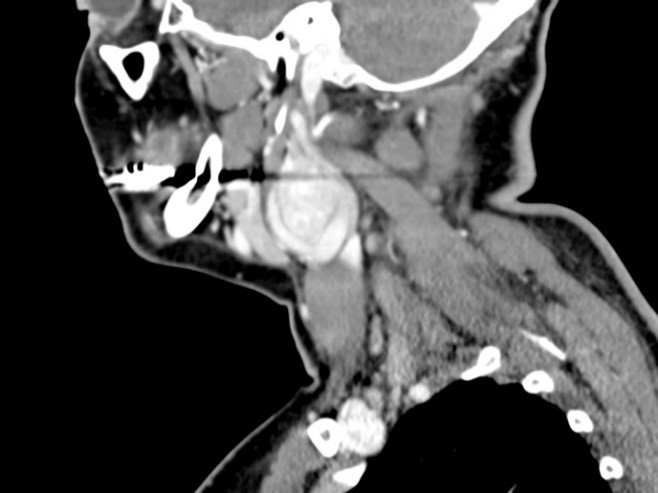 Caso Clínico ARP nº 23: Qual o seu diagnóstico?