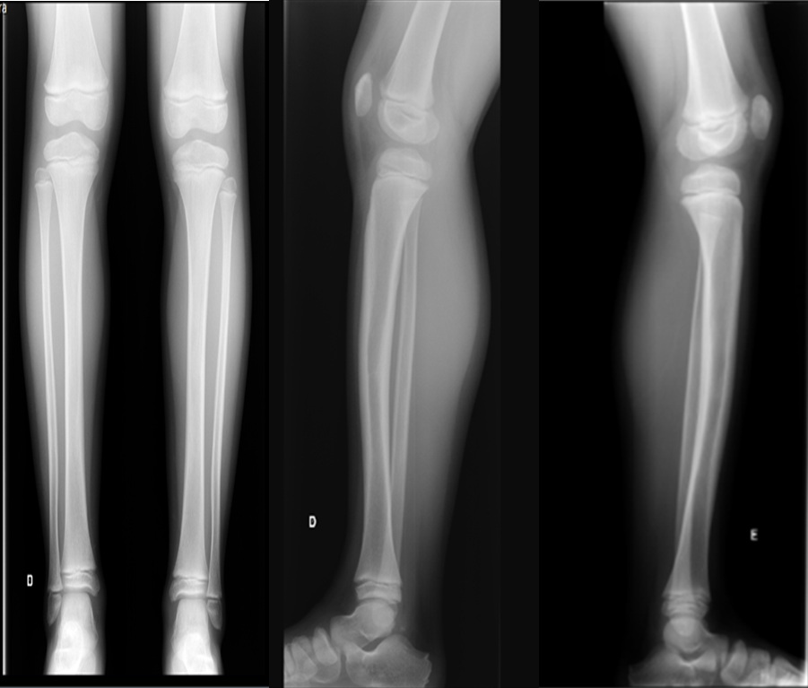 Soft tissue swelling in an infant: what is the diagnosis?
