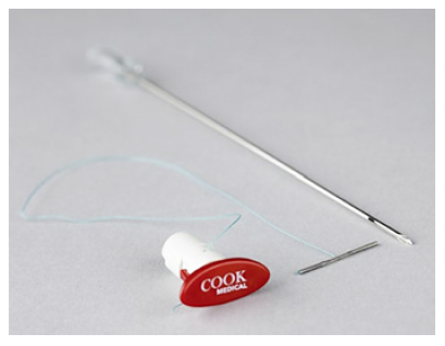 Percutaneous Endoscopic Sigmoidopexy: Still a Way to Go