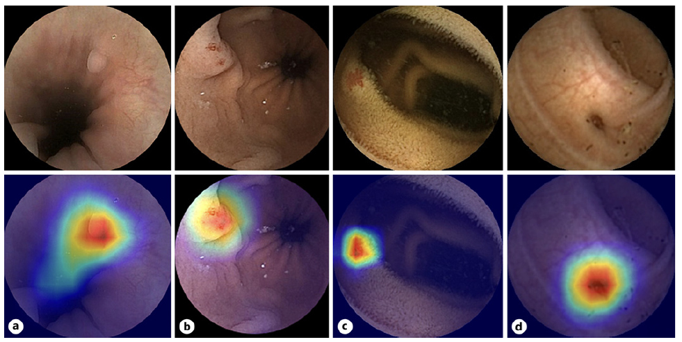 Deep Learning and Minimally Invasive Endoscopy: Panendoscopic Detection ...