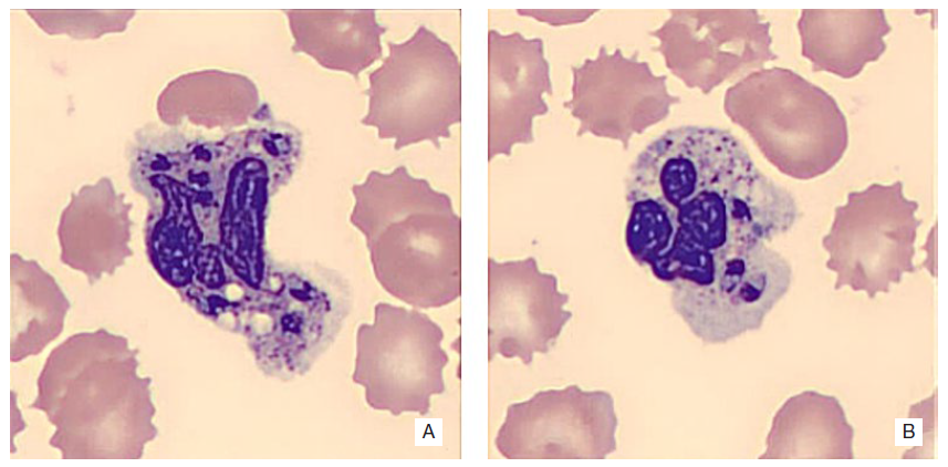 Leishmania in Peripheral Blood: An Unusual and Incidental Find