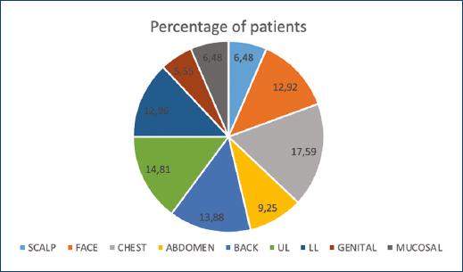 Measurement of quality of life of vitiligo using disease-specific ...