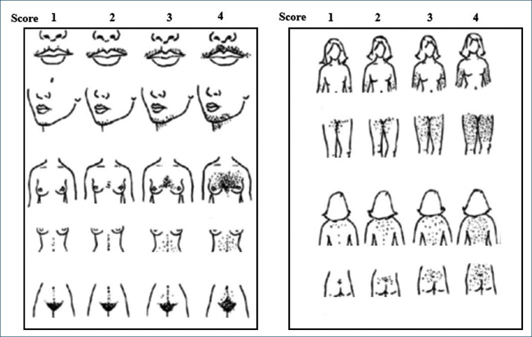 Polycystic ovary syndrome: a dermatologic approach