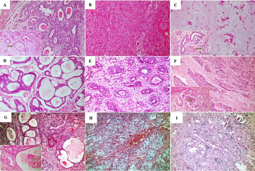 A 14-year retrospective study on clinical and histopathological ...