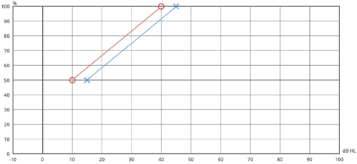Corrective saccades with normal VOR gain in vestibular schwannoma