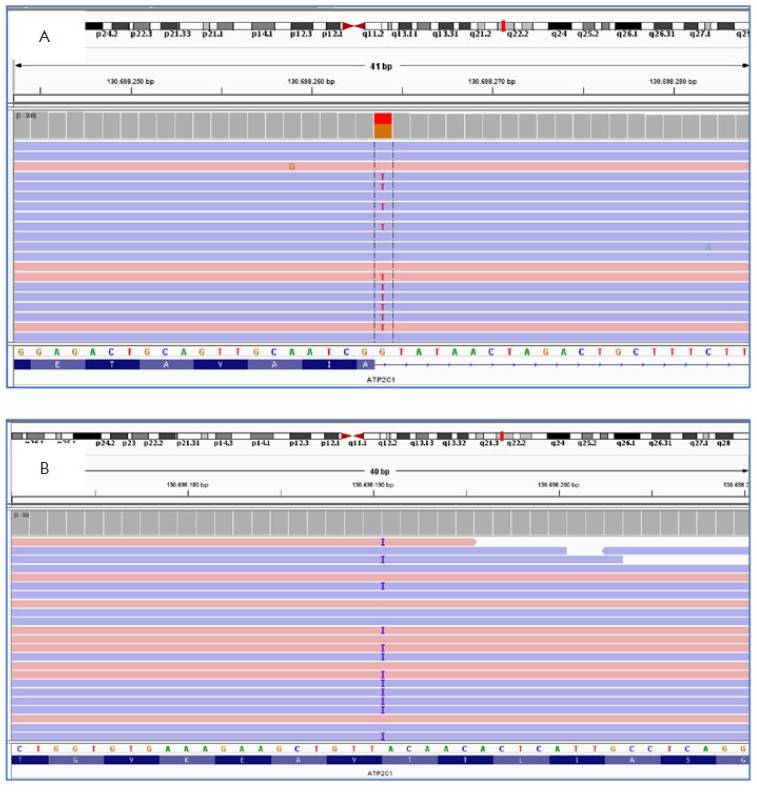 Two Novel ATP2C1 Mutations in Portuguese Patients with Hailey-Hailey ...